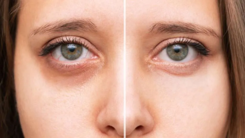 Picor de ojos – Causas y como aliviar esta molestia Oftálica